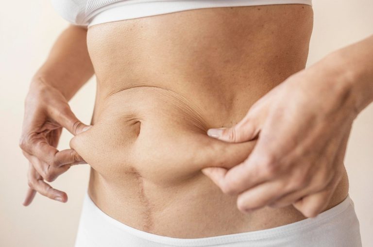 barriga-caida-consejos-eliminar